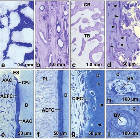 Transmission Electron Micrographs Of A Acellular Extrinsic Fiber