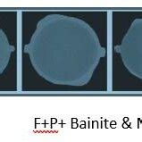 Ferritic Perlitic Are The Accepted Microstructures The Outer Ring