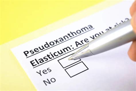 Pseudoxanthoma Elasticum Pxe Cauze Simptome Tratament Dr Max Farmacie