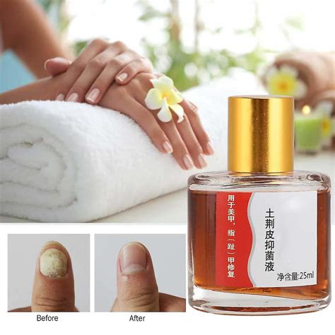 Anti Fungal Nail Fungus Treatment Liquid Onychomycosis Repair