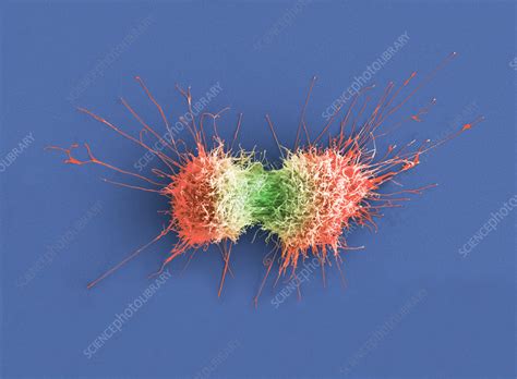 Cervical Cancer Cells Dividing Sem Stock Image C056 8078 Science Photo Library