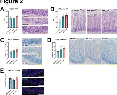Figure 2 From Working Title Intestinal Epithelial Adaptations To