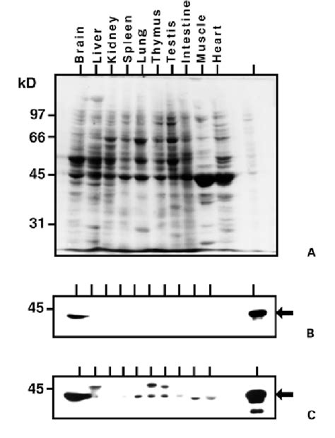 Figure 1 From Cellular And Subcellular Localization Of Necdin In Fetal