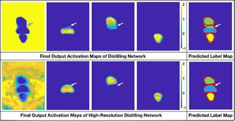 Figure 5 From High Resolution Encoderdecoder Networks For Low Contrast Medical Image