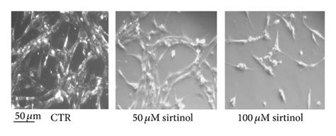 Sirt1sirt7 Expression In Hmscs And Effects Of Sirt1 Inhibition On