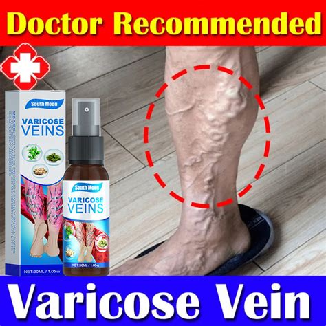 Best Selling In Europe 🔥southmoon Varicose Vein Treatment Cream Spray