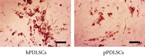Identification Of Hpdlscs And Ppdlscs The Surface Markers Of Hpdlscs