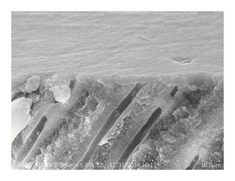 Representative Sem Photographs Of The Smear Layer Created By Two
