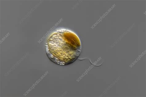 Coccolithophoride Algae Light Micrograph Stock Image C0574900