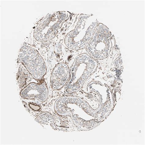 The Molecular Signature Of Human Testicular Peritubular Cells Revealed