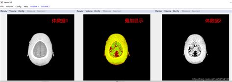 Matlab医学三维重建可视化库matlab超声曲面voi设计三维重建 Csdn博客