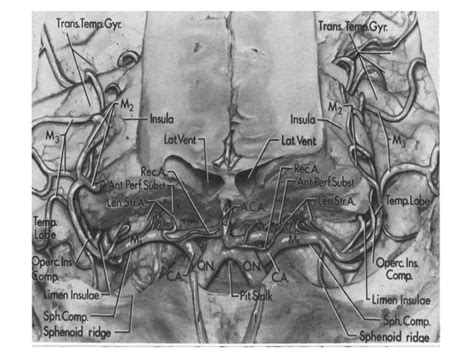 Middle Cerebral Artery Anatomy Ppt