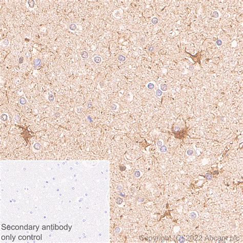 Anti Aldolase C N Terminal Antibody Epr26895 52 Ab302952 Abcam
