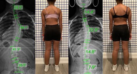 My Results Dr Tony Nalda
