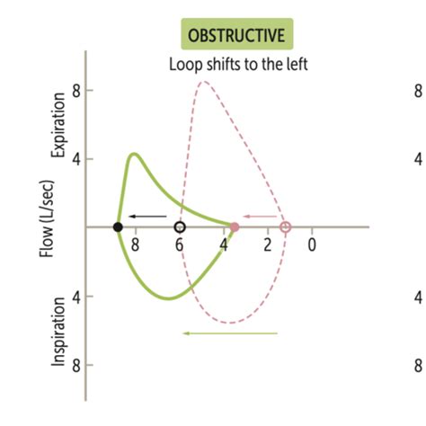Obstructive Lung Disease Flashcards Quizlet