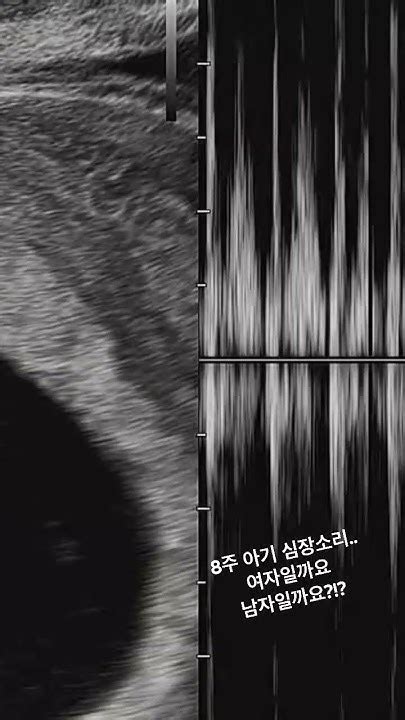태아심장소리 성별 기차소리 말발굽소리 Youtube