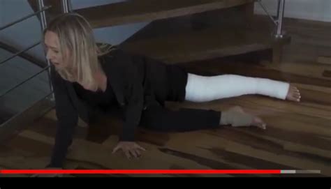 Clip 310 She Falls From The Second Floor Broken Leg In A Full Leg