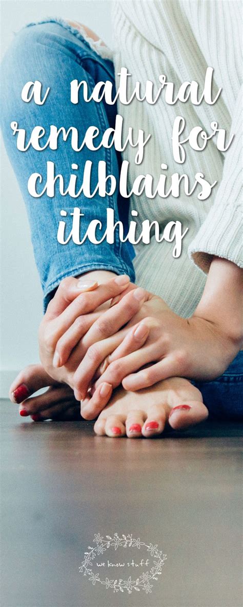This Natural Remedy Works How To Stop Chilblains Itching