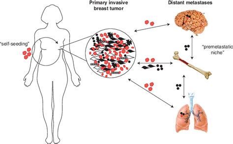 Systemic Effects Of Breast Tumors Tumor Cells Shed Into The Download Scientific Diagram