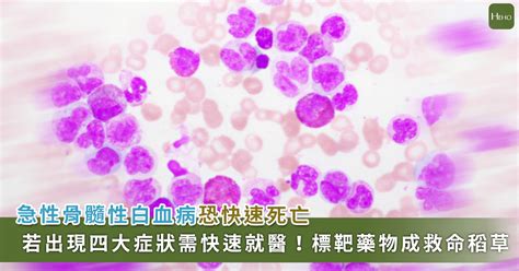 大陸前領導人江澤民去世！白血病常被誤為老化，注意 4 症狀快就醫 Heho健康