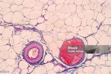 Gewebe Von Magen Mensch Dünndarm Mensch Bauchspeicheldrüse Mensch Und