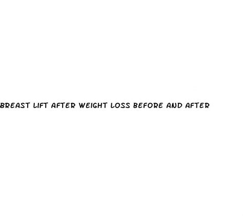 Breast Lift After Weight Loss Before And After Do Biguanides Cause