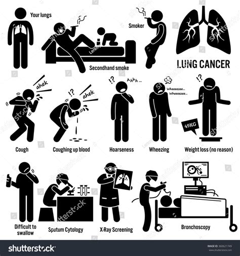 Lung Cancer Symptoms Causes Risk Factors Stock Illustration 360621749