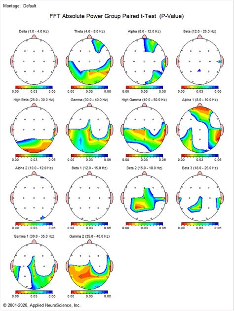 Absolute Power Paired T‐test P‐value Paired T‐test Was Used To
