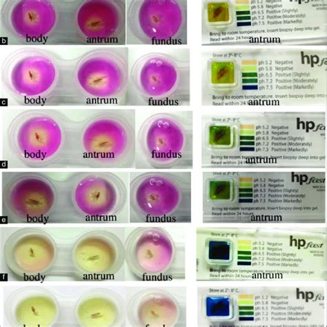 Gastric Biopsy Samples Of The Body Antrum And Fundus Were Analyzed By