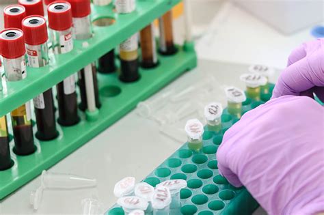 Clinical Laboratory Services Laboratory Medicine And Pathobiology