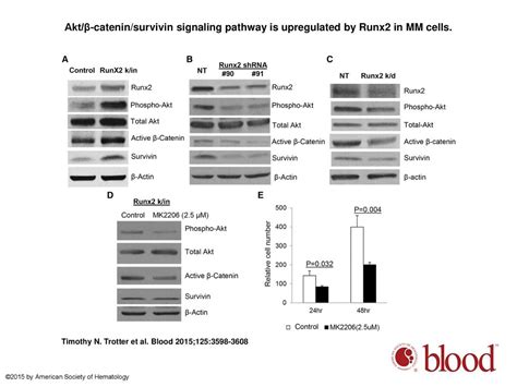 Myeloma Cell Derived Runx2 Promotes Myeloma Progression In Bone Ppt