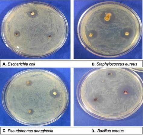 Optimization Of Surface Sterilization Method For The Isolation Of
