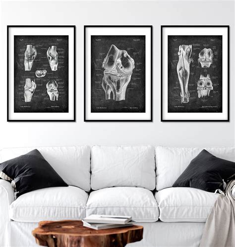 Knee Anatomy Chart Chalkboard Style Codex Anatomicus