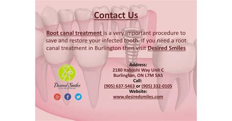 All You Need To Know About Root Canal Treatment In Burlington