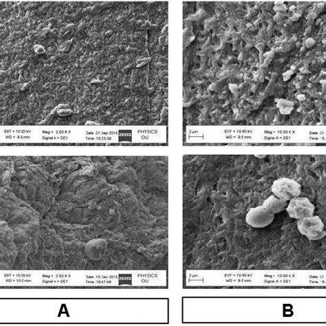 Scanning Electron Microscopy Sem Pictures Of The Advanced Download Scientific Diagram