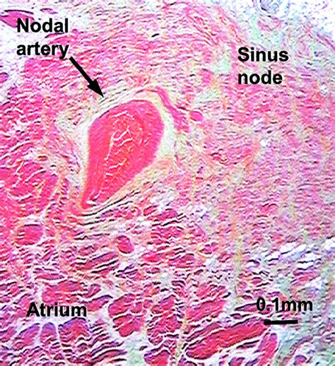 Anatomic Electrophysiological Correlations Concerning The Pathways For