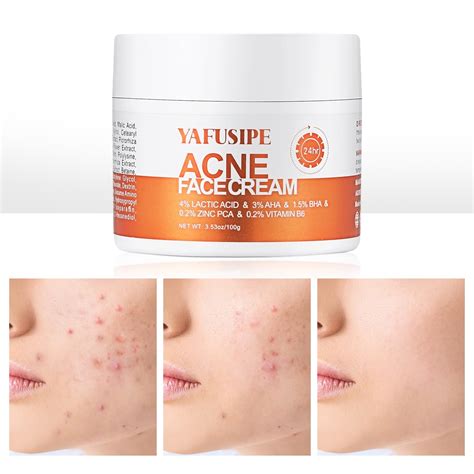 Yafusipe Acne Treatment For Face For Hormonal Cystic Stubborn Acne