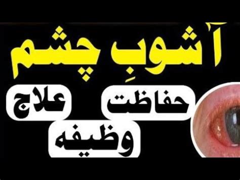 Ashob E Chashm Ka Ilaj Eye Infections Treatment Rohani Ilaj