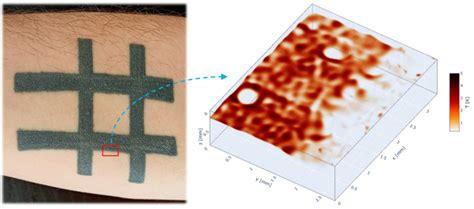 Biomedical Optics Ijs Department Of Complex Matter