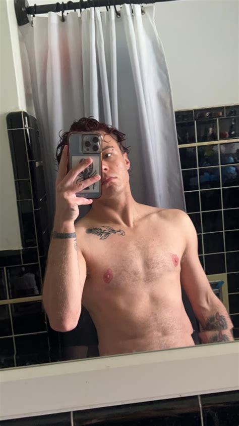 6 Years On T And Almost 4 Years Post Op
