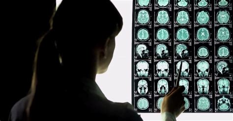 Accidentul Vascular Cerebral Ischemic Cel Mai Frecvent Diagnosticat