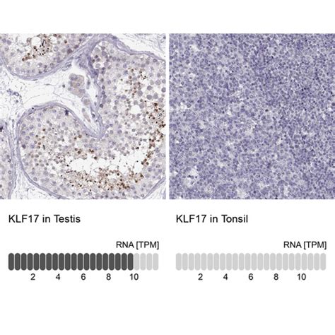 Rabbit Polyclonal Anti Klf17 Antibody Buy For Research Highly