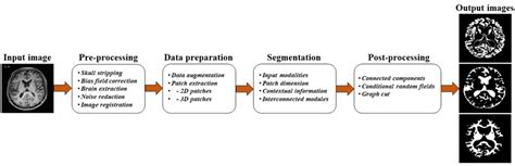 General Pipeline For Brain Mri Analysis General Pipeline For Brain Mri Download Scientific