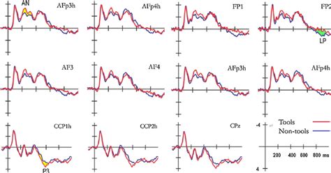 Grand Average Erp Waveforms Recorded At Left And Right Anterior