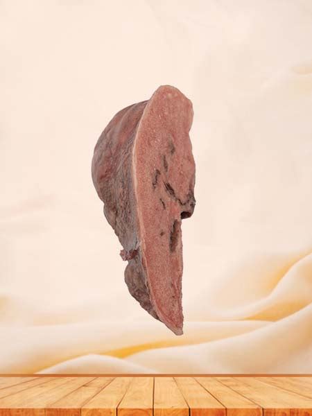 Pathlogy Liver Anatomy Model