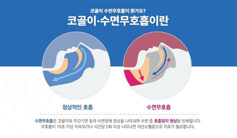 코골이 · 수면무호흡 굿모닝이비인후과