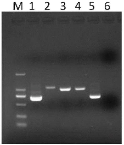 Primer Kit And Method For Detecting Porcine Reproductive And Respiratory Syndrome Viruses