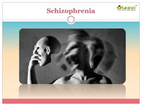 Ppt Strabismus Causes Symptoms Daignosis Prevention A