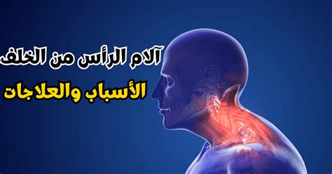آلام الرأس من الخلف الأسباب والعلاجات