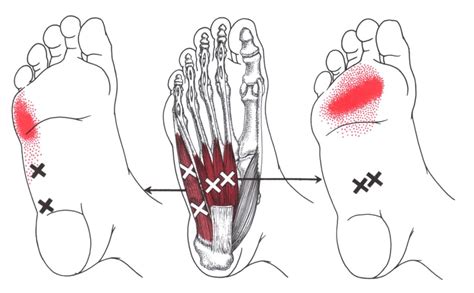 Flexor Hallucis Brevis And Flexor Digitorum Brevis Learn